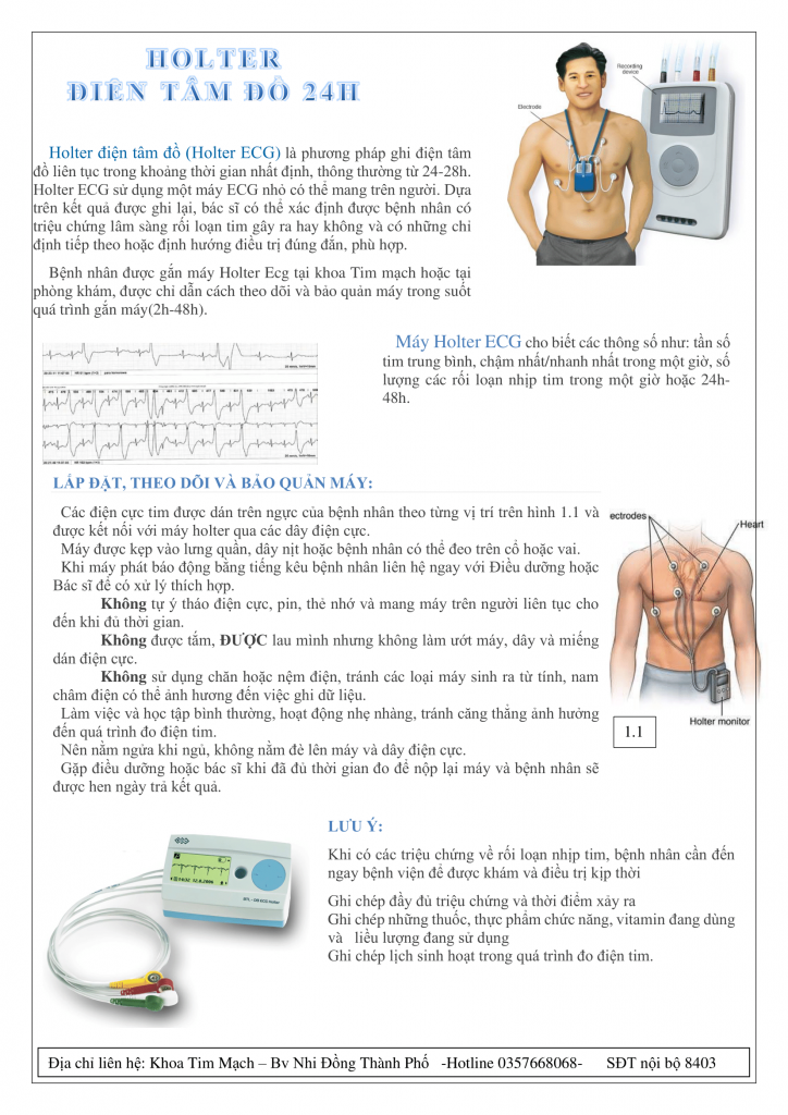 Holter điện tâm đồ 24H - Bệnh Viện Nhi Đồng Thành Phố